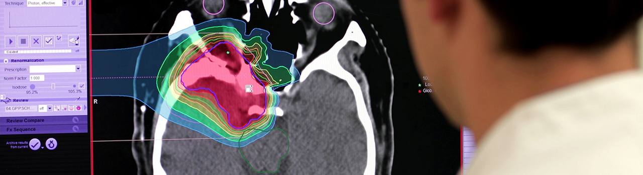 The particle therapy